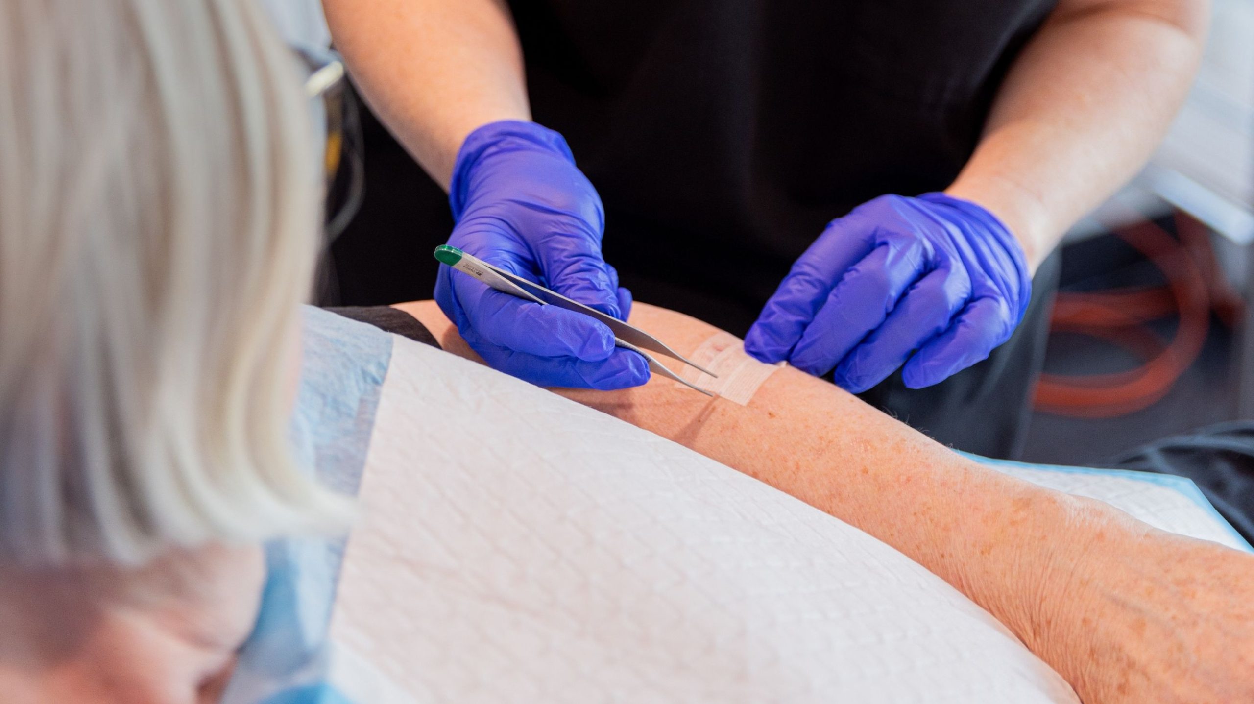 Surgical Removal | Skin Institute