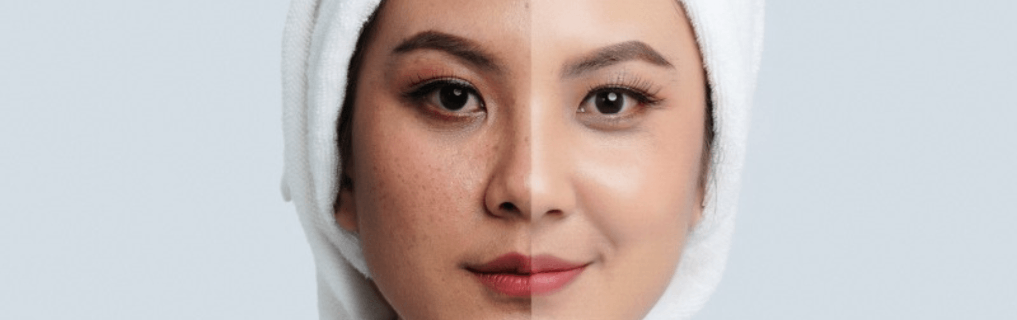 3 daily steps to rid blotchy uneven skin | Skin Institute