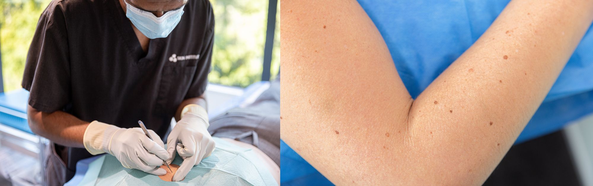 Inside Our Surgical Room: How We Remove Skin Cancers | Skin Institute