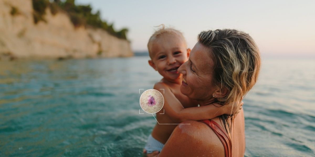 SkinTracker™ | Skin Institute